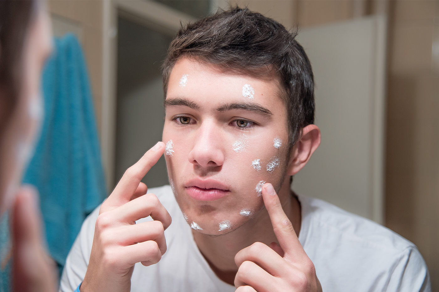 Treating Male Acne The Right Way Stylespeak